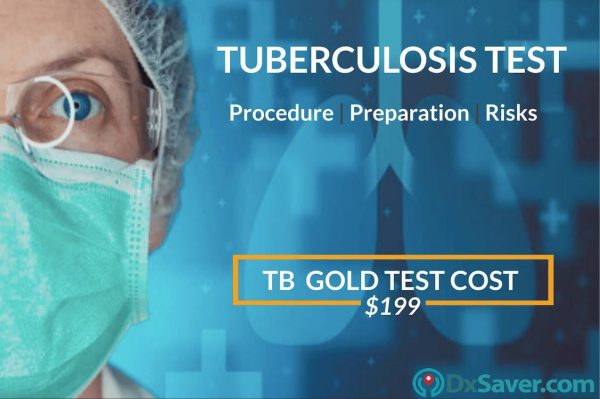 Get Lowest Quantiferon Gold Test Cost At 199 Book Online Now 